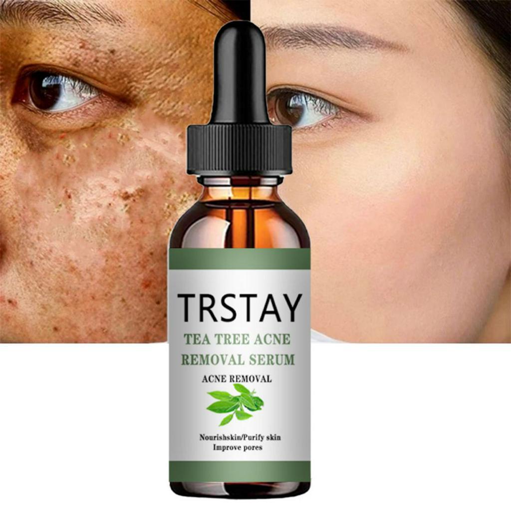 5ML/15ML/30ML/50ML/Acne Treatment Face Serum Tea Tree Oil Essence ...
