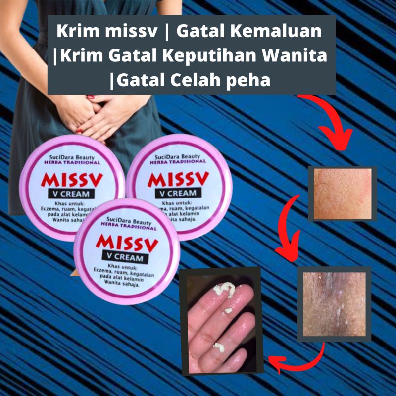Promo🔥 KRIM MissV HILANGKAN GATAL WANITA 🔥 Gatal Keputihan Eczema 🔥 ...