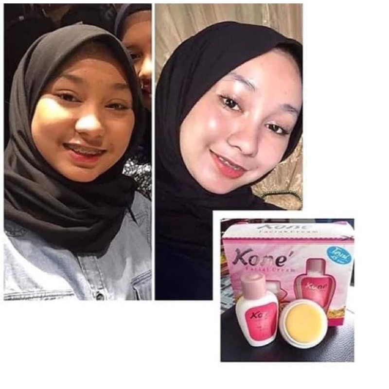 KONE FACIAL CREAM ORIGINAL 💯 | Shopee Malaysia