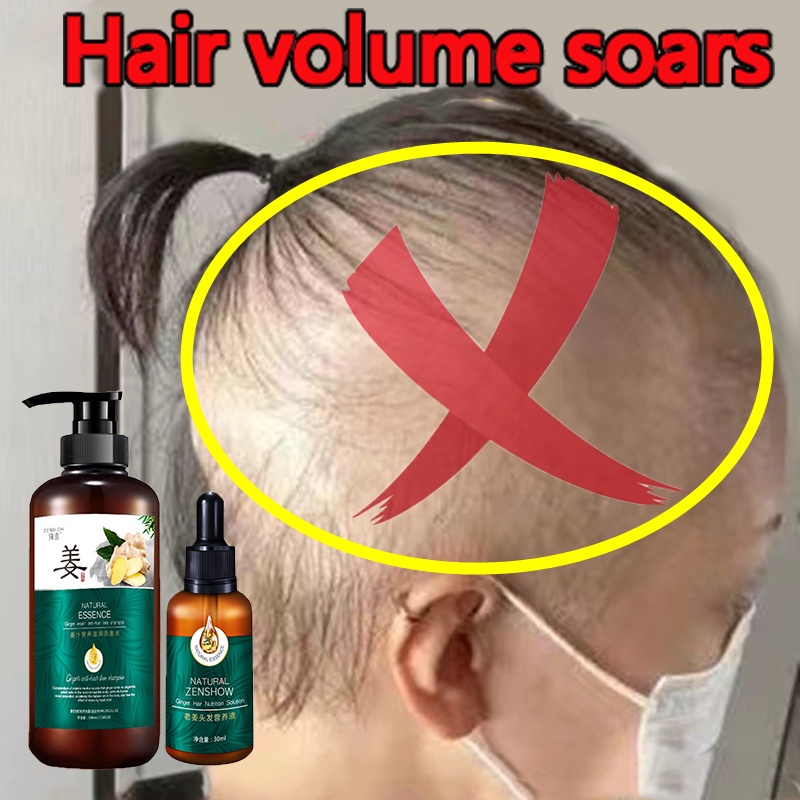 Ginger He Shou Wu Anti Hair Loss Shampoo Growing Hair Nourishes Hair Roots Dandruff Oil Control ...