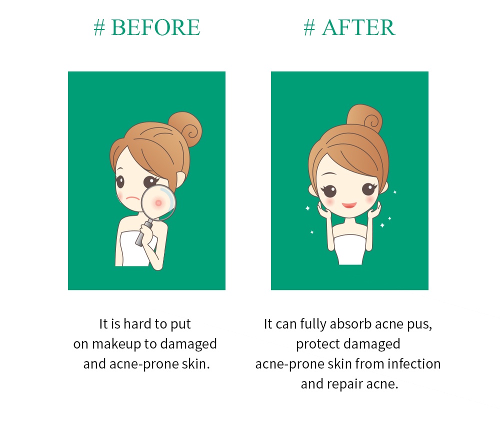 BREYLEE Tea Tree Acne Pimple Patch Day/Night Remover Treatment Skin (22 ...