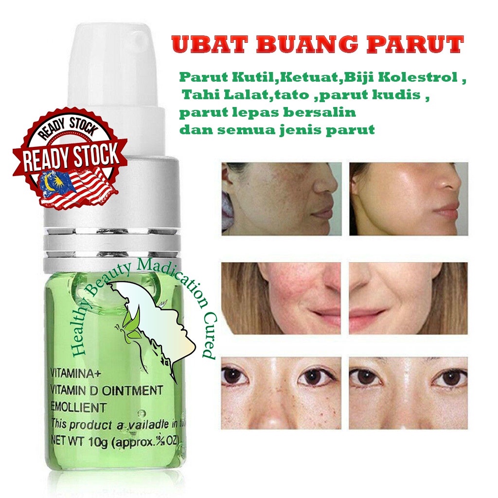 UBAT HILANG PARUT -Kutil,Ketuat,Biji Kolestrol,Tahi Lalat ,parut kudis ...