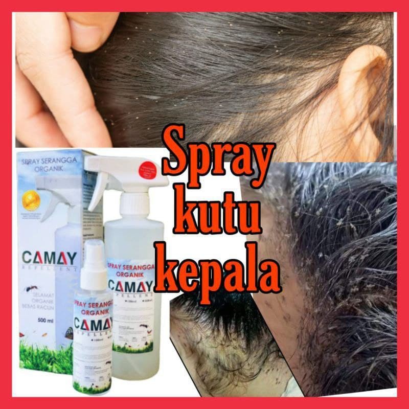 Ubat Kutu Kepala Rambut Natural Head Lice Camay Repellent Tiada Bau