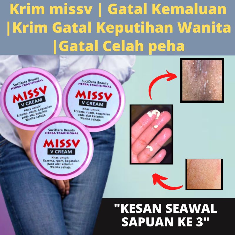 💥SHIP 24 HOURS💥KRIM MissV UNTUK MERAWAT KEPUTIHAN | GATAL CELAH ...