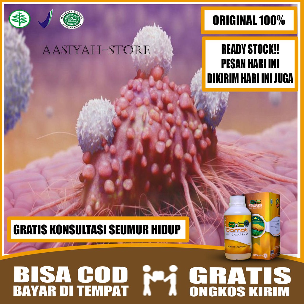 MATA Gastric Cancer Medicine, Cancer Laring, Tongue Cancer, Eye Cancer, Melanoma Cancer, Mouth ...