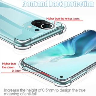 Soft Case VIVO Y100 Y03 Y17s Y36 Y35 Y22 Y22s Y16 Y02 Y02A Y02T Y02s Y27 Y78 Y21 Y21s Y21t Y20 ...