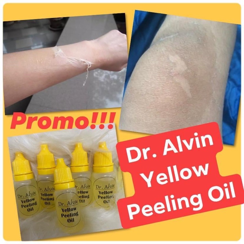 Dr. Alvin Peeling Oil(repack) 10ml for body(not face) | Shopee Malaysia