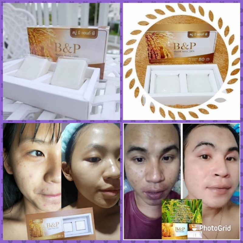 BP FACE SOAP 100% ORIGINAL THAILAND | Shopee Malaysia