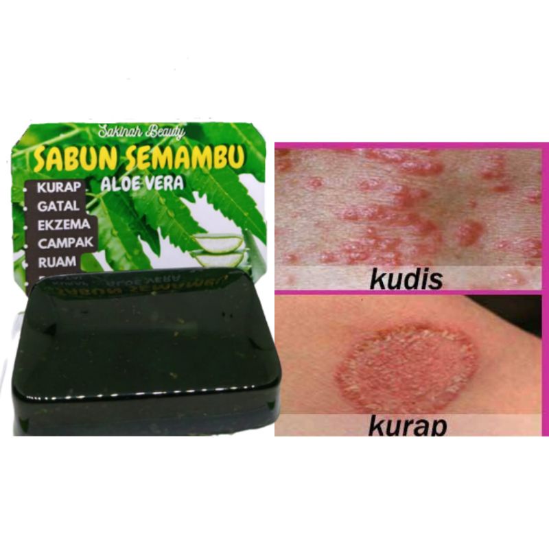 Sabun Semambu Kurap Gatal Panau Ekzema | Shopee Malaysia