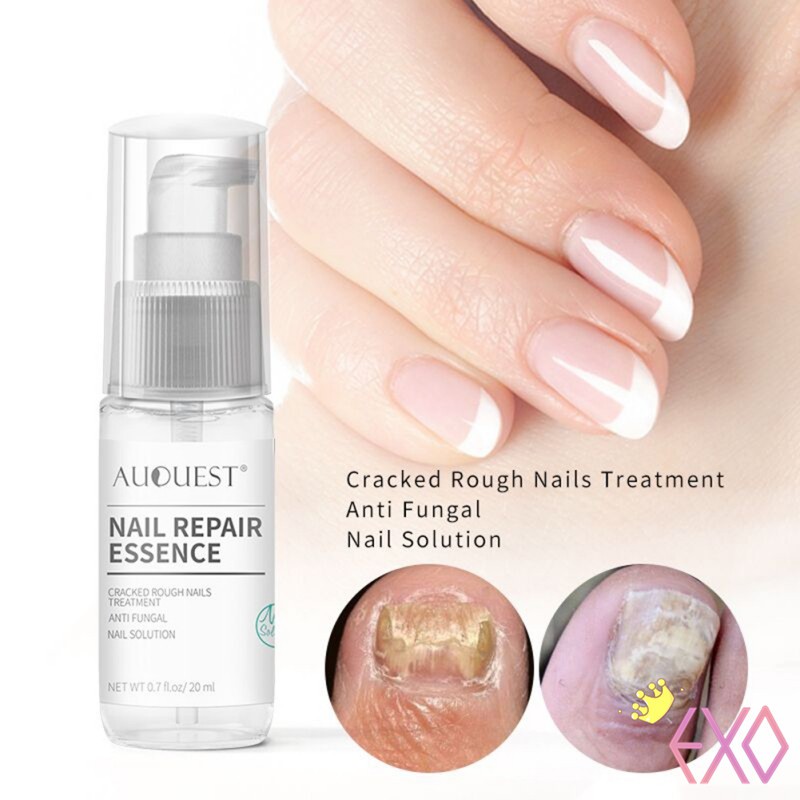 Nail Repair Solution Anti Fungus Onychomycosis Repair Crack Nail Toe ...
