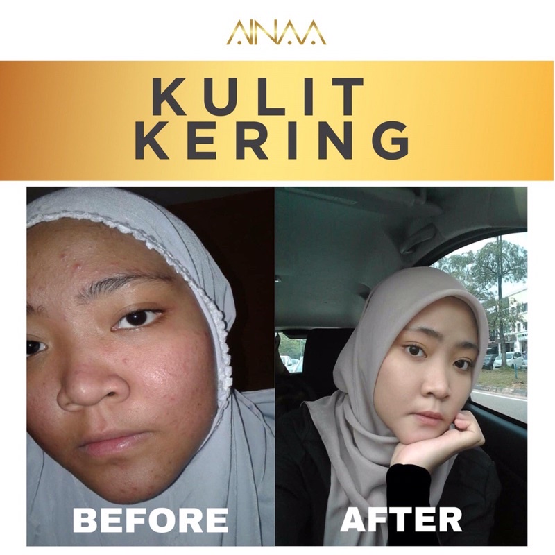 ‼️ READY STOCK ‼️ 💯 ORIGINAL AINAA SKINCARE BY SYAFIQAH AINAA . SETIAP ...
