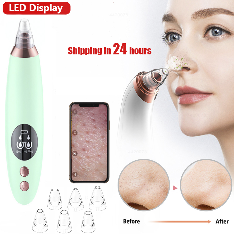 USB Rechargeable Blackhead Remover Face Pore Vacuum Skin Care Acne Pore ...