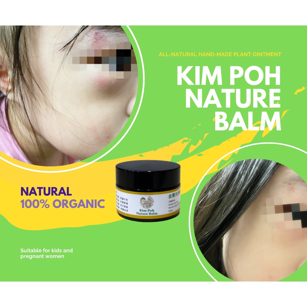 *New Release* Kim Poh Nature Balm 金宝天然药膏 | Shopee Malaysia
