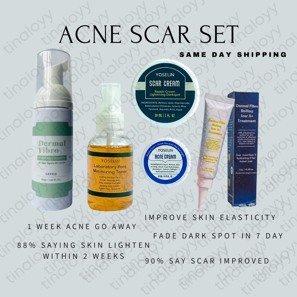 Yoseline® ICEPICK SCAR, BOX SCAR, KELOID SCAR, PITTED SCAR Derma ...