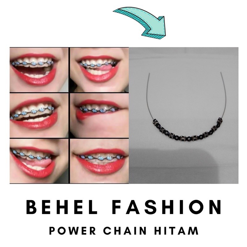 HITAM Fashion Braces Removable And Install The Black Power Chain Model ...
