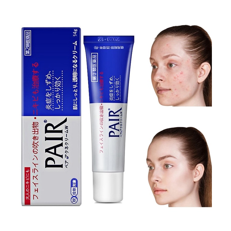 Pair Acne Lion Cream W 24g | Shopee Malaysia