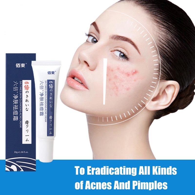 acne cream pimple remover cream skin care products Whitening acne ...