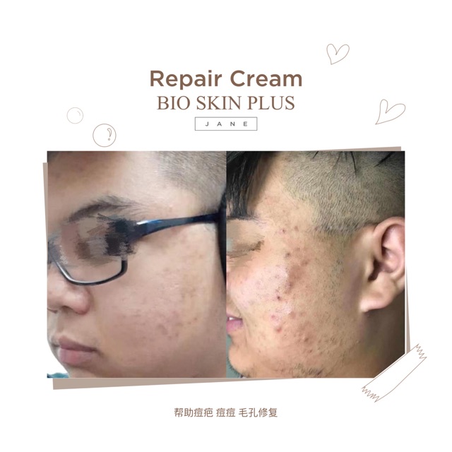 Bio skin plus ( 1 mist + 1 cream) | Shopee Malaysia