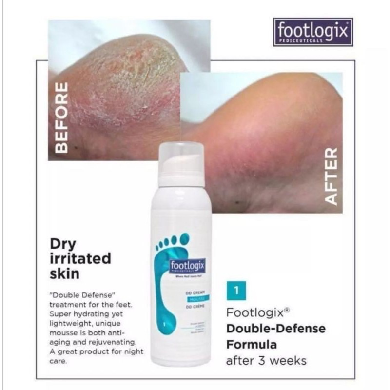 Footlogix DD Cream Mousse Formula (125ml) | Shopee Malaysia