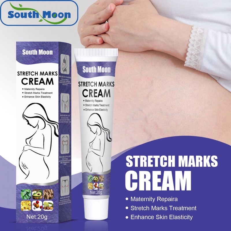 SOUTHMOON STRETCH MARKS CREAM krim Rawatan stretch marks selulit ...