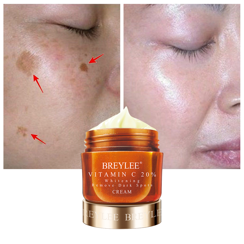BREYLEE Vitamin C Whitening Facial Cream VC Fade Freckles Remove Dark Spots Brightening Face ...