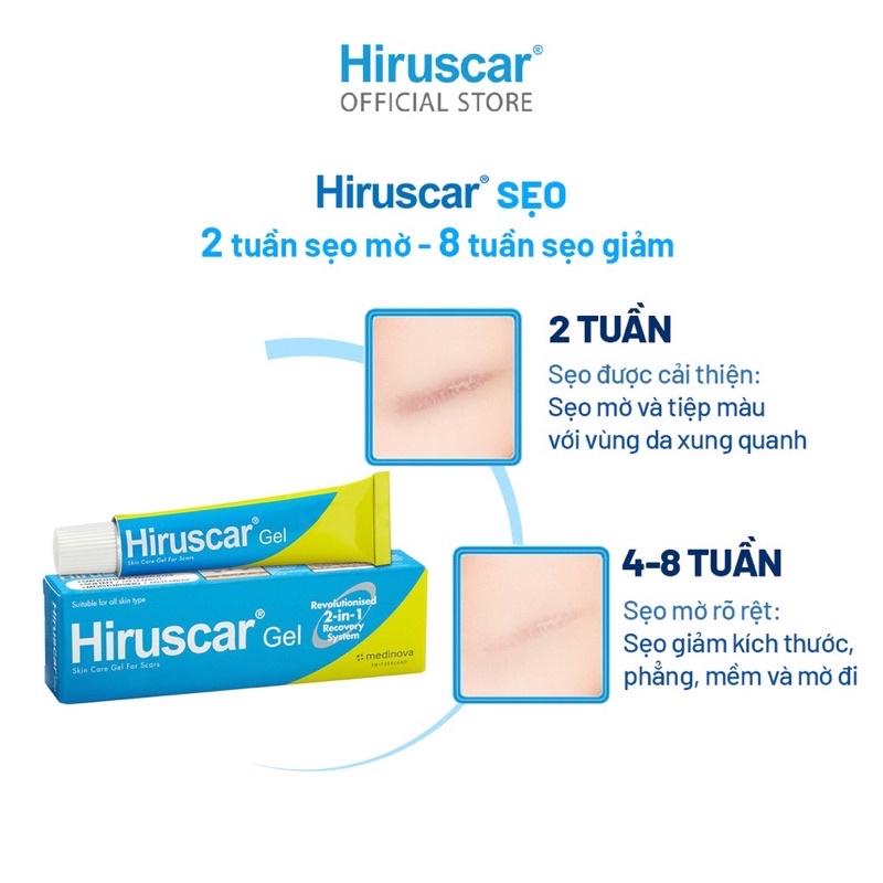 Hiruscar scar removal cream (Genuine product) | Shopee Malaysia