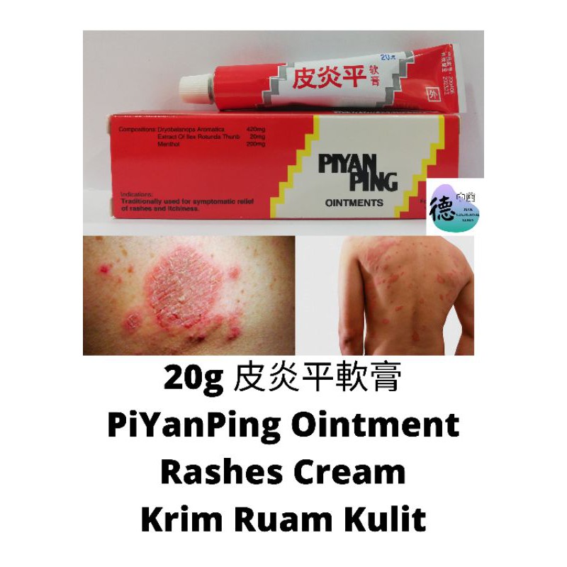 20g 皮炎平軟膏 Pi Yan Ping Ointment Rashes Cream, Krim Ruam Kulit | Shopee ...