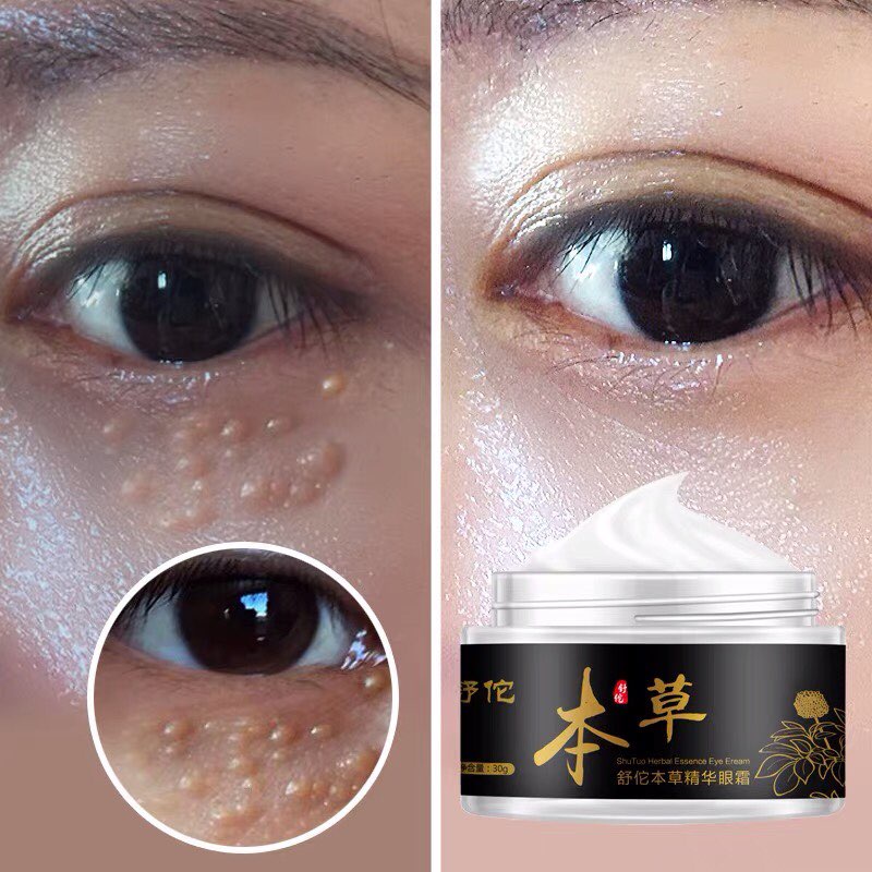 Cream for warts - skin tags - dark eye circles - moisturizing eyes ...