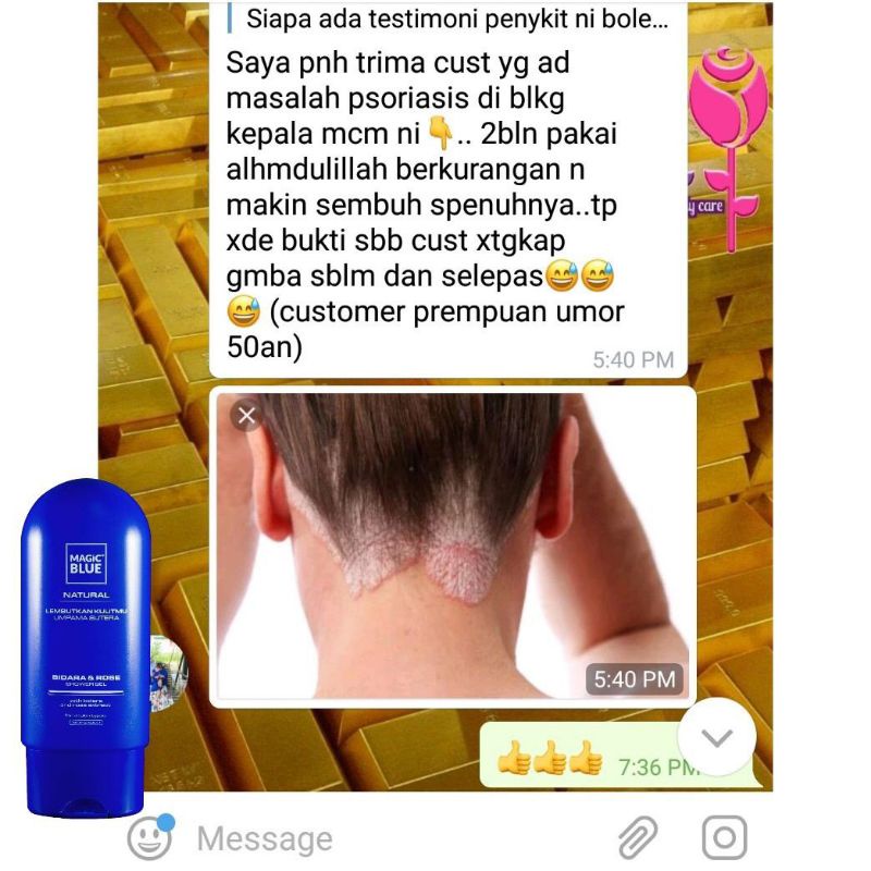 MEXBLU Shower Gel Bidara Rose | Rambut | Kulit | Muka | Eczema ...