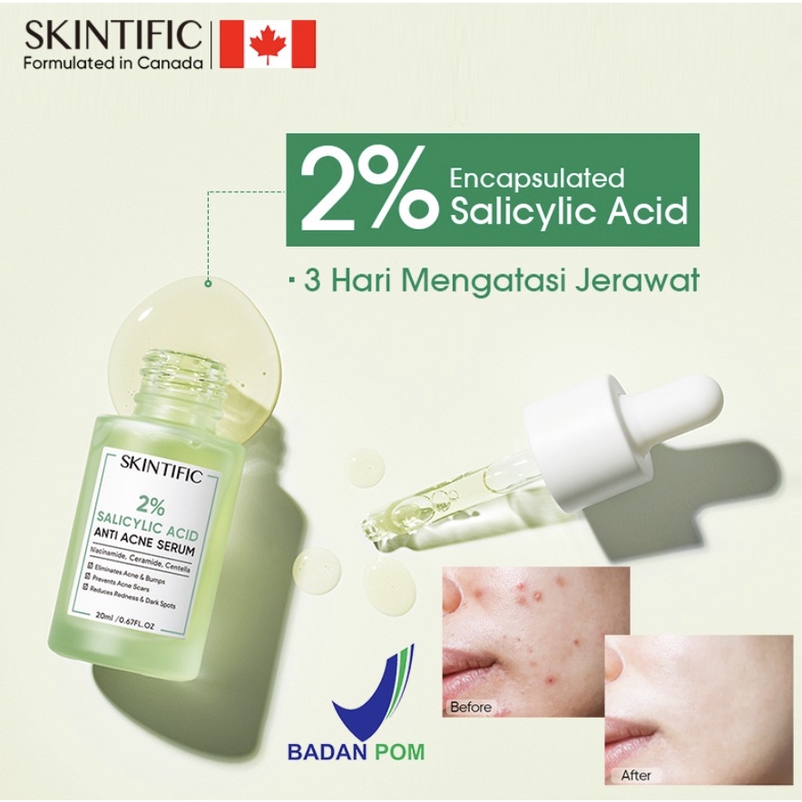 Skintific 2% Salicylic Acid Anti Acne Serum | Shopee Malaysia