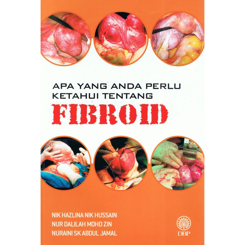 Apa Yang Anda Perlu Ketahui Tentang Fibroid 9789834611644 | Shopee Malaysia