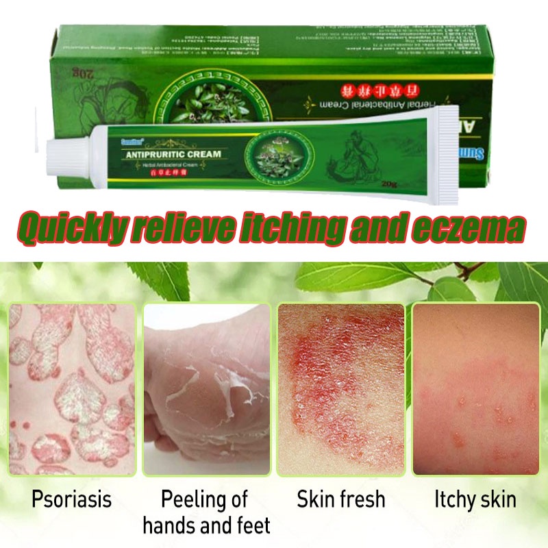Eczema Cream Treatment Anti Bacterial Skin Fungus Cream Psoriasis