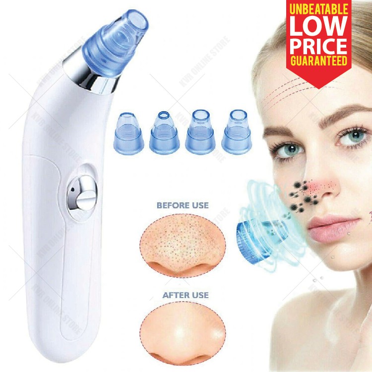 Blackhead Removal Nose Vacuum Suction Facial Cleansing Spot | Shopee ...