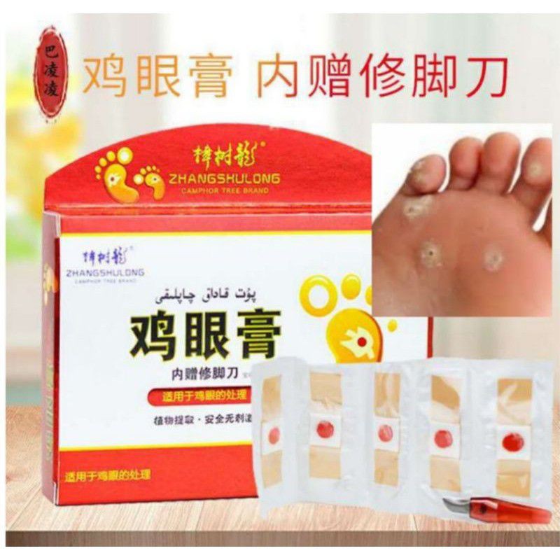 鸡眼贴 5/sticker Corn paste to remove the foot corn plaster to remove the ...