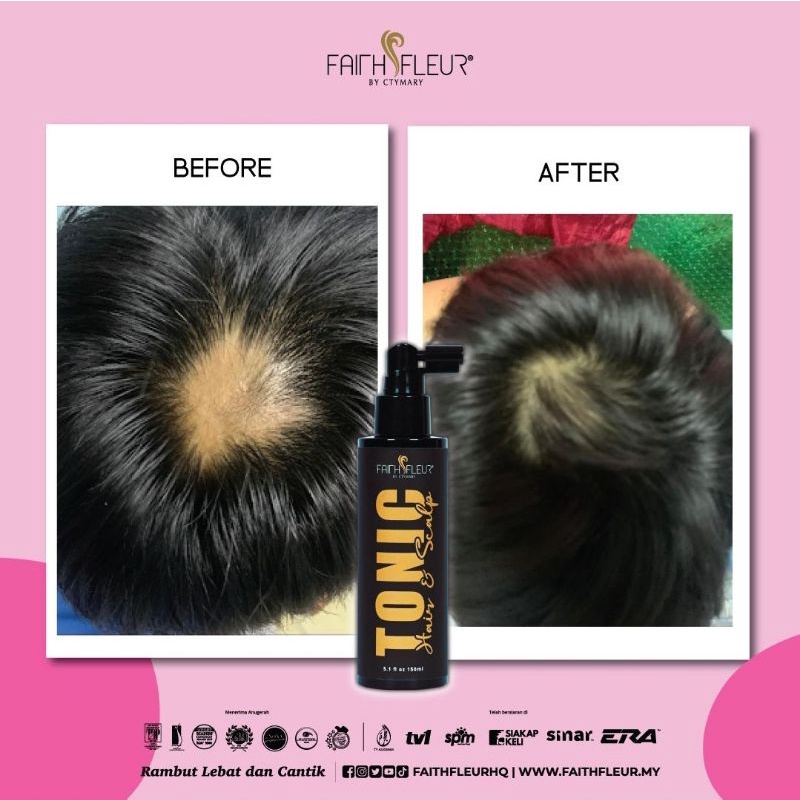 PELEBAT NO 1🔥 HAIR TONIC 150ML PELEBAT RAMBUT FAITH FLEUR | Shopee Malaysia