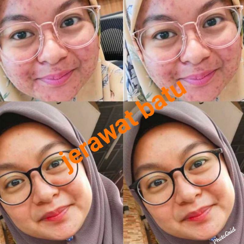 📍SET TRIAL TABITA RM80📍 | Shopee Malaysia