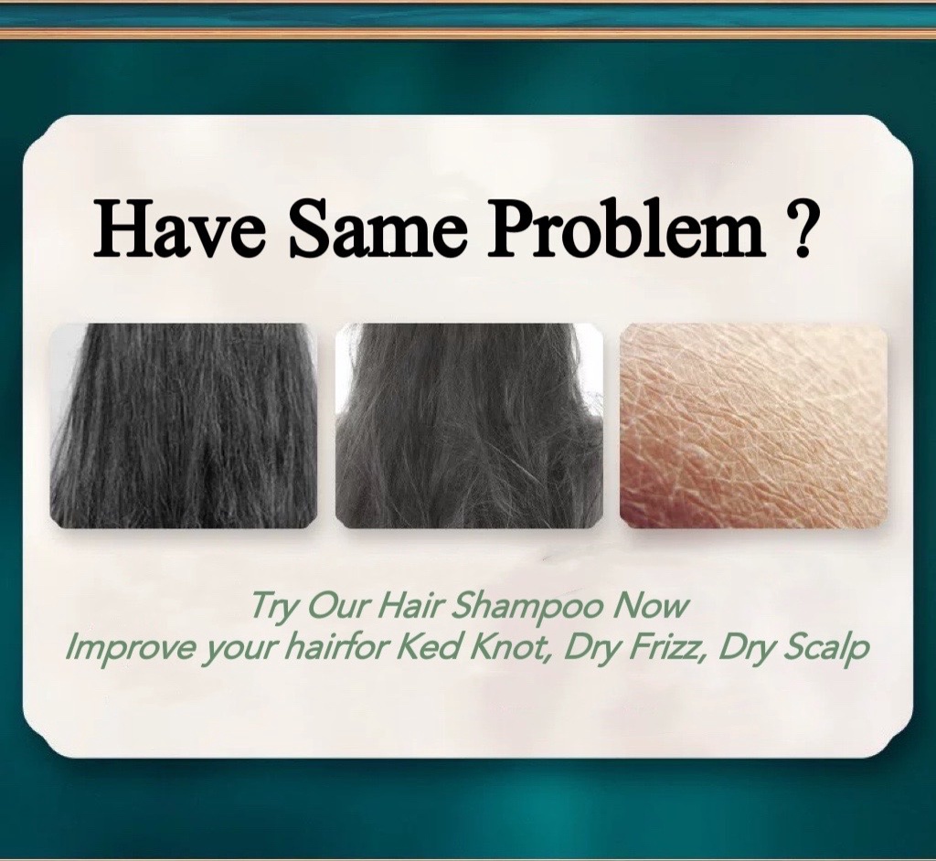 Korea HANFEN 】Hair Shampoo Anti-dandruff 500ML Hair Conditioner Anti ...