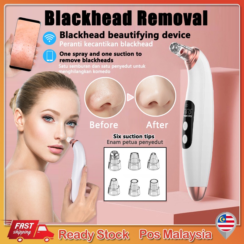 【Blackhead Removal】Blackhead Remover Facial Skin Cleanser Vacuum ...