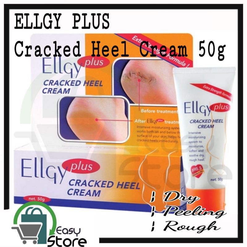Ellgy Plus Cracked Heel Cream 50g | Shopee Malaysia