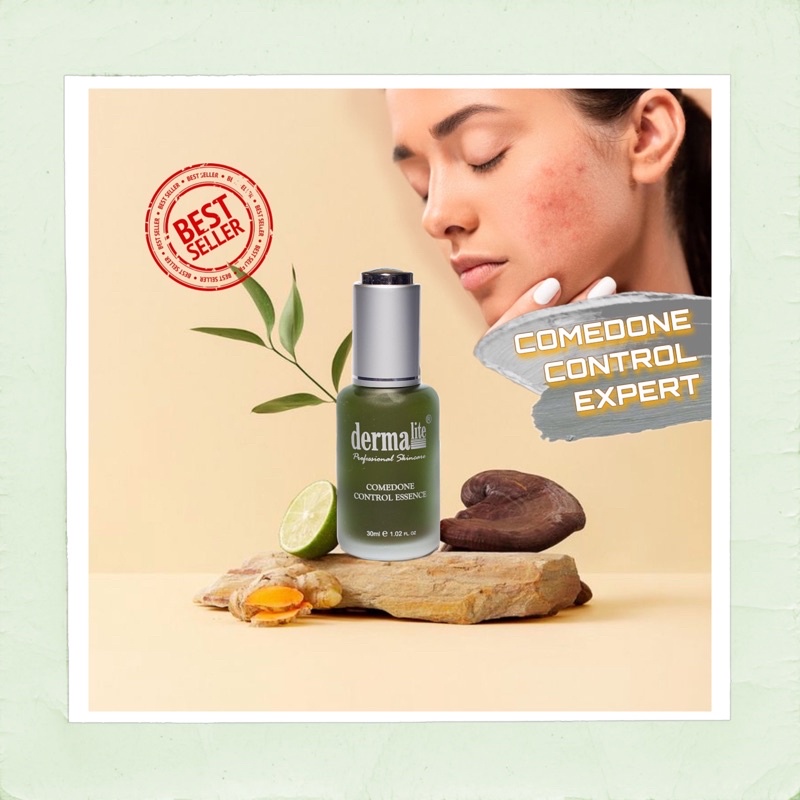 DERMALITE COMEDONE CONTROL ESSENCE SKIN SERUM Eliminates ACNE ...