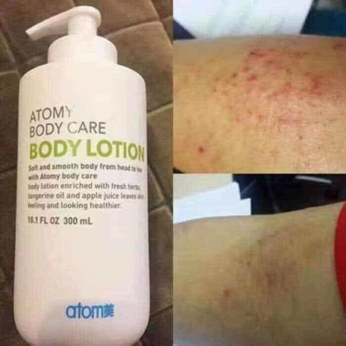 Atomy Body Lotion 300ML X1 (艾多美身体乳液- 草本配方还有清热解毒，凉血除疣的功效, 消除疤痕, 让皮肤更有光泽 ...