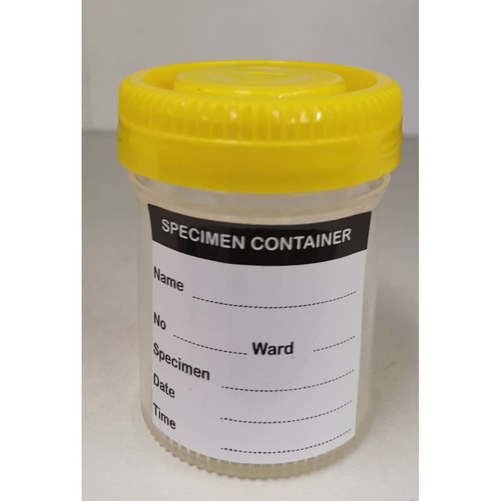URINE SPECIMEN CONTAINER 60mL WITH LABEL 1'S | Shopee Malaysia