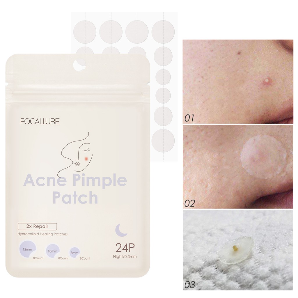 Focallure Waterproof Acne Patch Blemish Treatment Skin Care Acne Repair ...