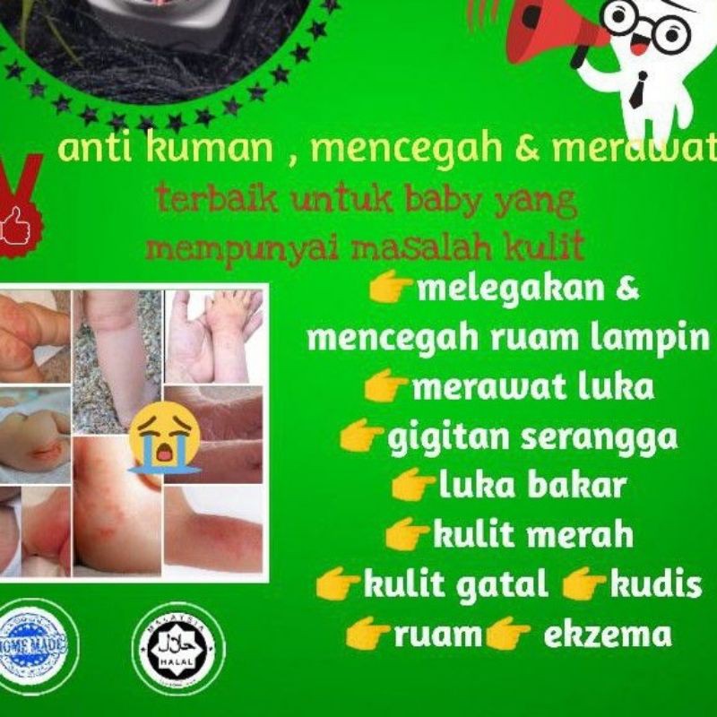 krim gatal/krim ruam lampin/krim ekzama | Shopee Malaysia