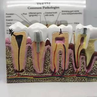 Suitable for School Dentistry Standard Oral Dental Anatomy Teaching ...
