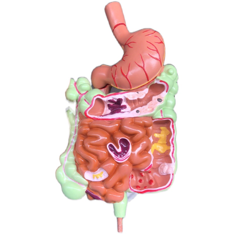 Human Stomach Gastrointestinal / Digestive System / Intestine Gastro ...