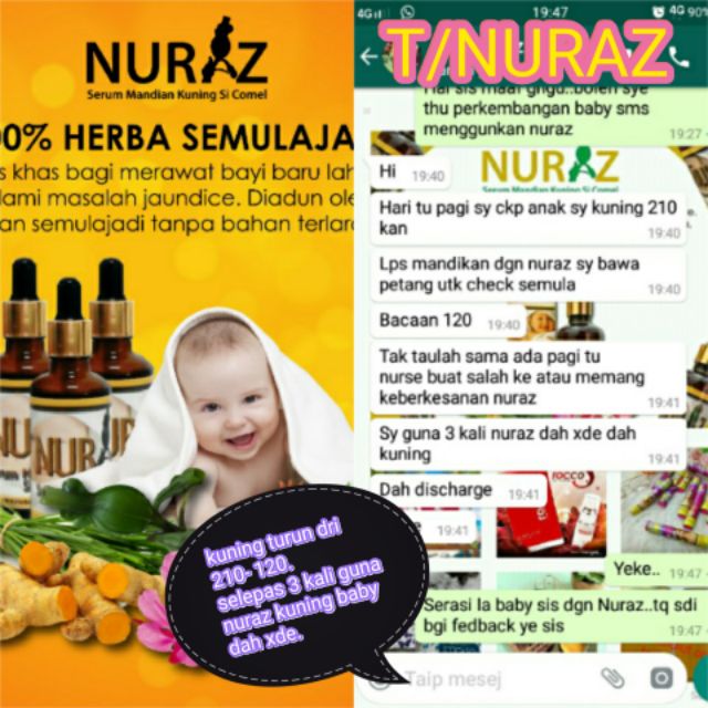 NURAZ - MANDIAN DEMAM Kuning exp 2026 | Shopee Malaysia