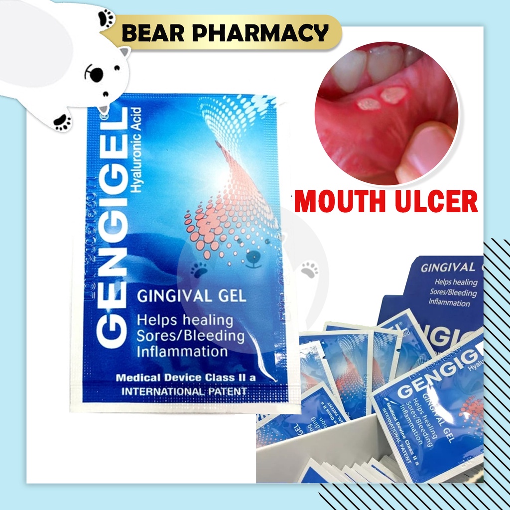 GENGIGEL Sachet 1ml 1 Pack/ 5 Packs [Exp: 2025] Gingivitis, Gingival ...