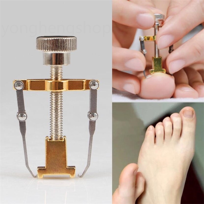 Straightening Clip Ingrown Toenail Corrector Pedicure Foot Nail Care ...
