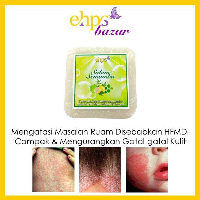 SABUN SEMAMBU || RAWAT SAKIT KULIT | Shopee Malaysia
